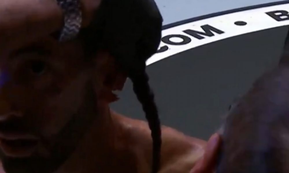 Dilacerada! Lutador sofre lesão feia na orelha no boxe sem luvas; veja ...